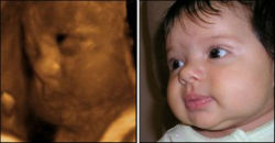 Pro-life sonogram event in DC shows babies, not cells - Marriage ...