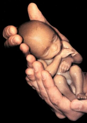 Protecting the unborn in a 'throwaway culture' - Living Faith - Home ...