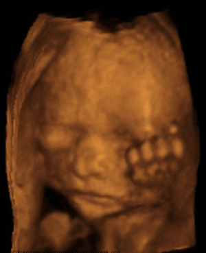 An average of 27 late-term abortions happen every day in the United ...