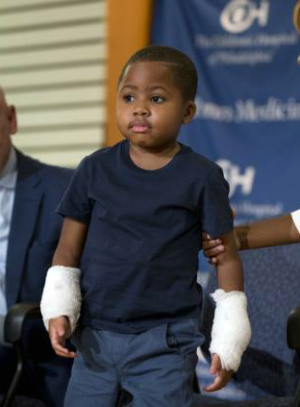 8-year-old boy becomes youngest double-hand transplant patient - Health ...