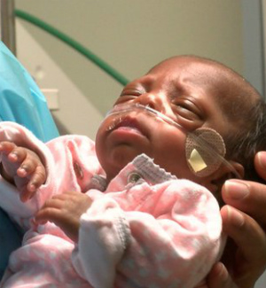 World's smallest surviving baby, born MORE THAN THREE MONTHS premature ...