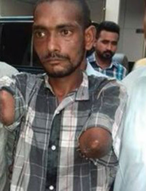 Man loses arms as punishment for loving Christ - Middle East ...