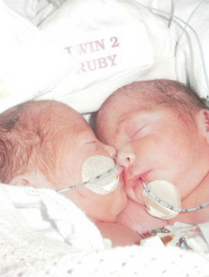 'They couldn't tell what was connecting them': Miraculous story of ...