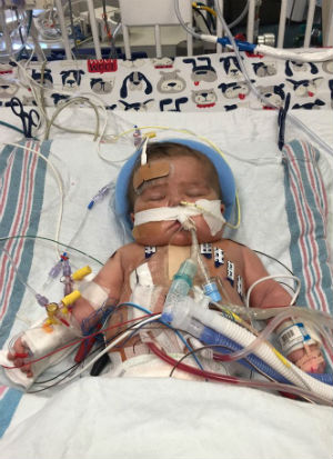 WATCH NOW Baby's heart beats outside body (WARNING: GRAPHIC CONTENT ...